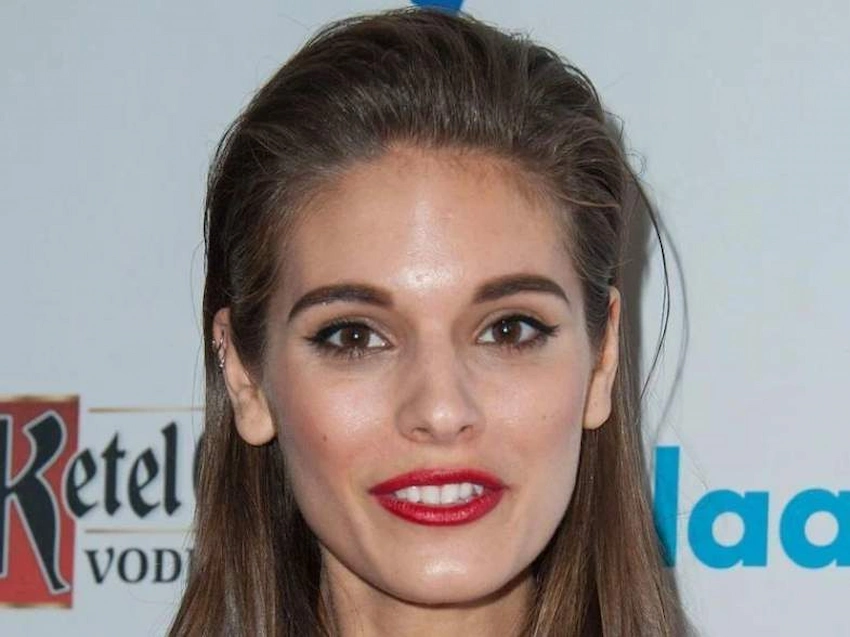 Histoire du sourire de Caitlin Stasey : dents naturelles vs parfait ...