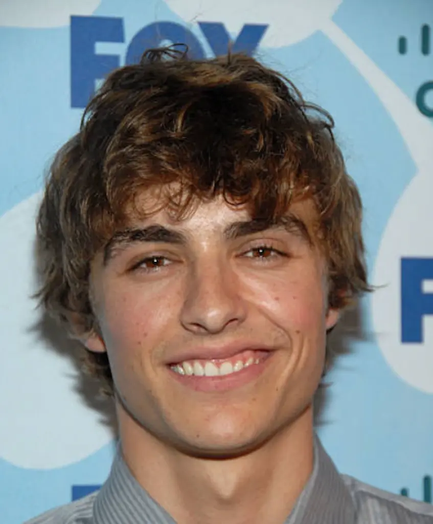 Dave Franco Teeth Before and After: Modern Smiles | LEMA