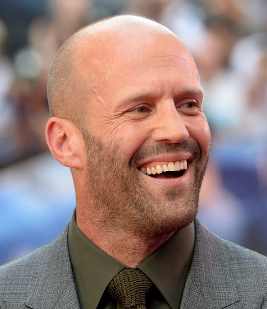 Dinții lui Jason Statham: Are Jason Statham fațete | Lema Dental Clinic
