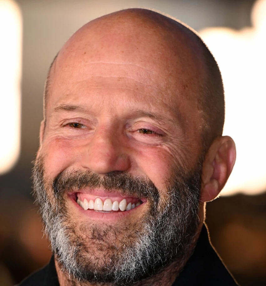 Jason Statham Teeth: Does Jason Statham Have Veneers? | LEMA