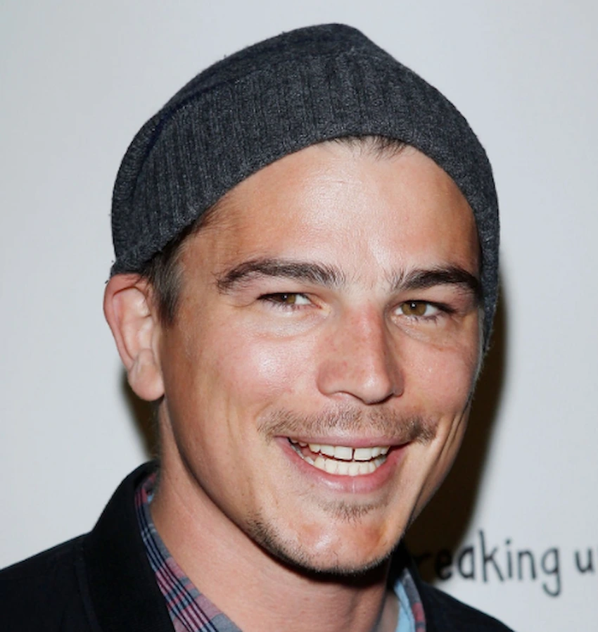 Josh Hartnett's Teeth Makeover: From the Early 2000s to Today | LEMA