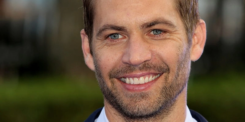 Paul Walker's Teeth: A Hollywood Smile Story | LEMA