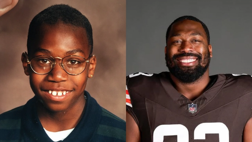 Shelby Harris's Teeth Story: Braces and Veneers | LEMA