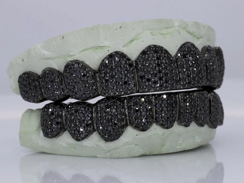 Black Diamond for Teeth: Risks and Benefits | LEMA
