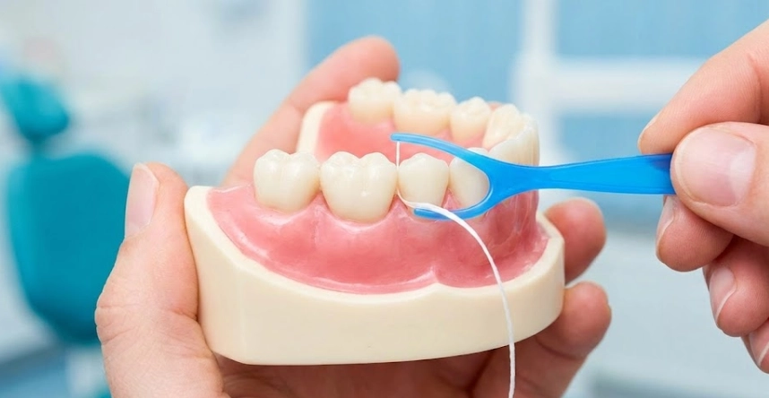 The Complete Guide to Using Dental Floss for Bridges | LEMA