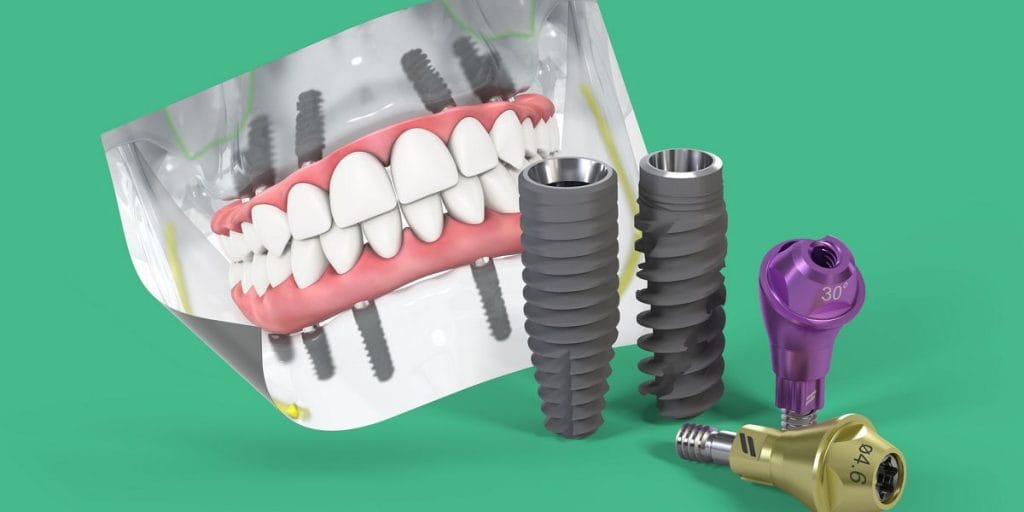 🦷Straumann Dental Implants: A Review | LEMA