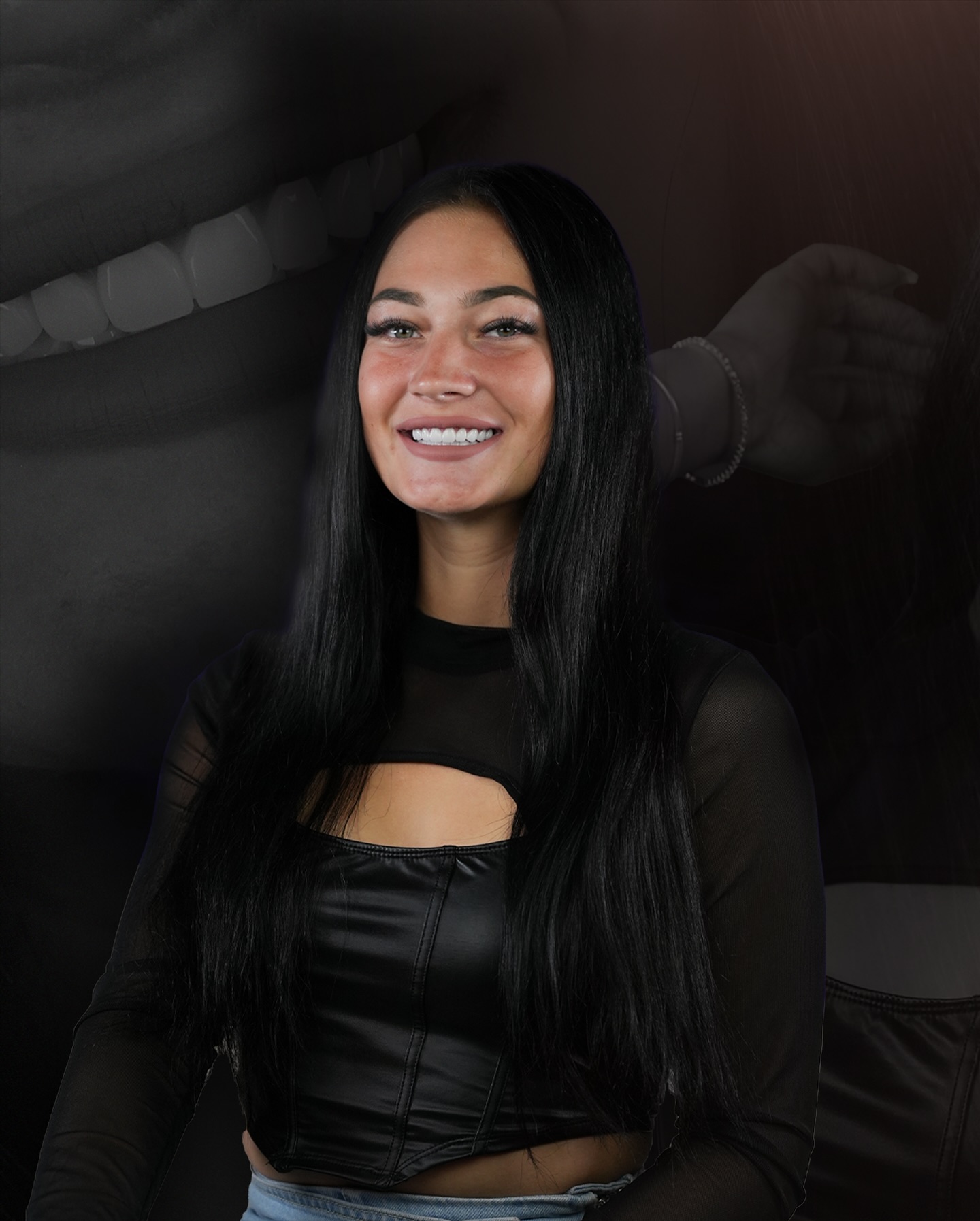 Are Veneers Permanent or Just a Temporary Fix? - Lema Dental Clinic Are Veneers Permanent or Just a Temporary Fix? - Lema Dental Clinic