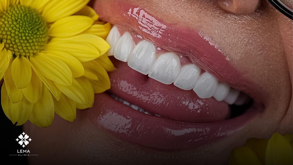 Dental Decay And Tooth Cavities 2025 - Lema Clinic