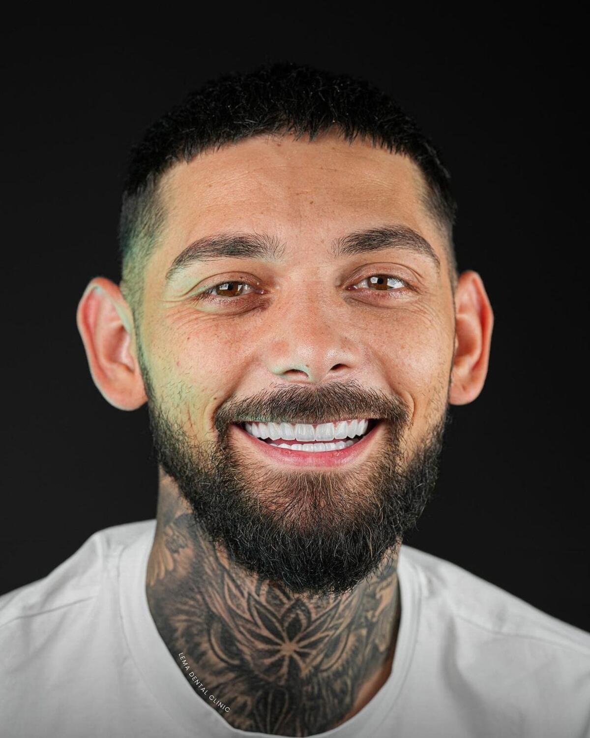 Perfect Smile Tips And Tricks 2025 - Lema Dental Clinic