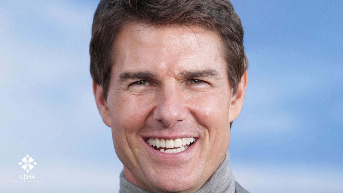 How To Get Like Tom Cruise Teeth? 2025 - Lema Clinic