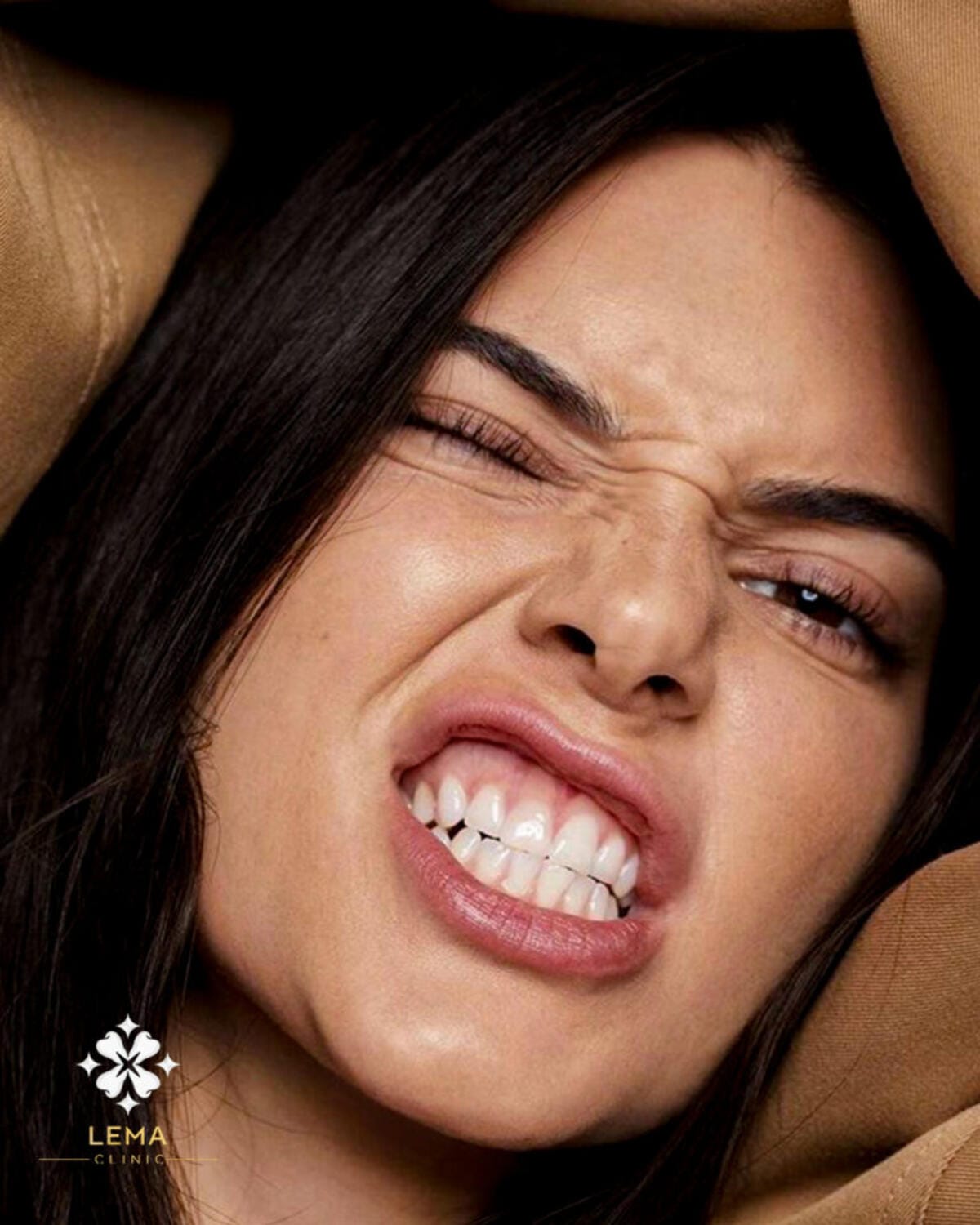 Kendall Jenner's Smile Journey 2024 - Lema Dental Clinic