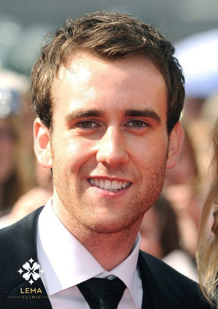 Matthew Lewis Teeth Makeover 2025 - Lema Dental Clinic