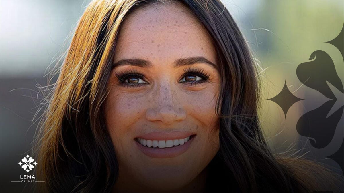 Meghan Markle Smile Transformation