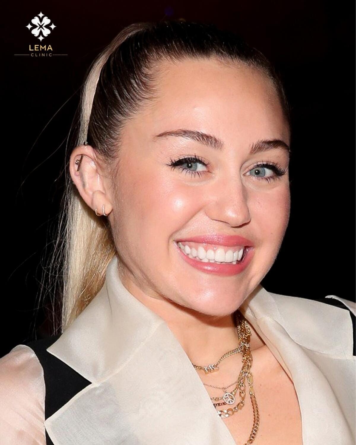 Le Voyage Du Sourire Hollywoodien De Miley Cyrus Dévoilé