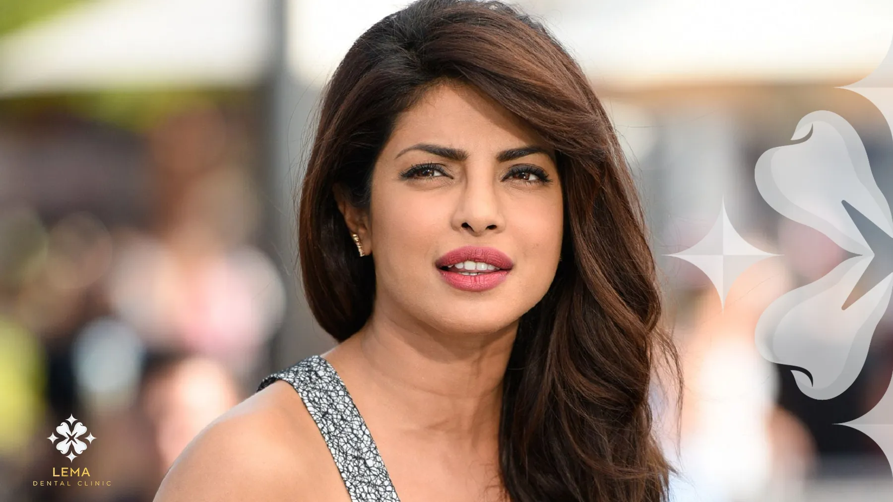 How Priyanka Chopra’s Stunning Teeth Makeover 2025