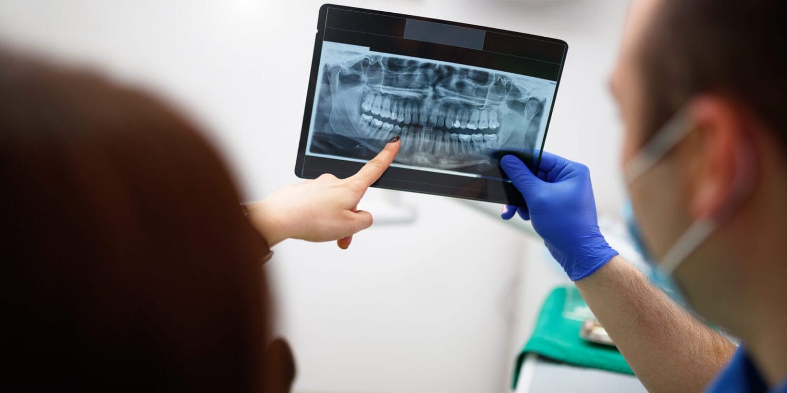 🦷 ¿Cómo se trata un diente impactado | Lema Dental Clinic